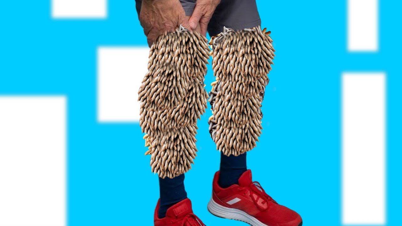 ASMR animation treatment infection leg. How to remove worms infested ...