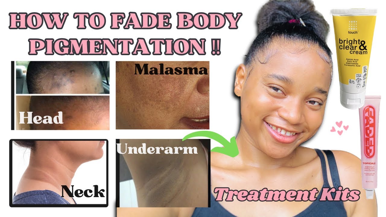 HOW TO FADE HYPERPIGMENTATION COMPLETELY ️| Face and Body Treatment ...