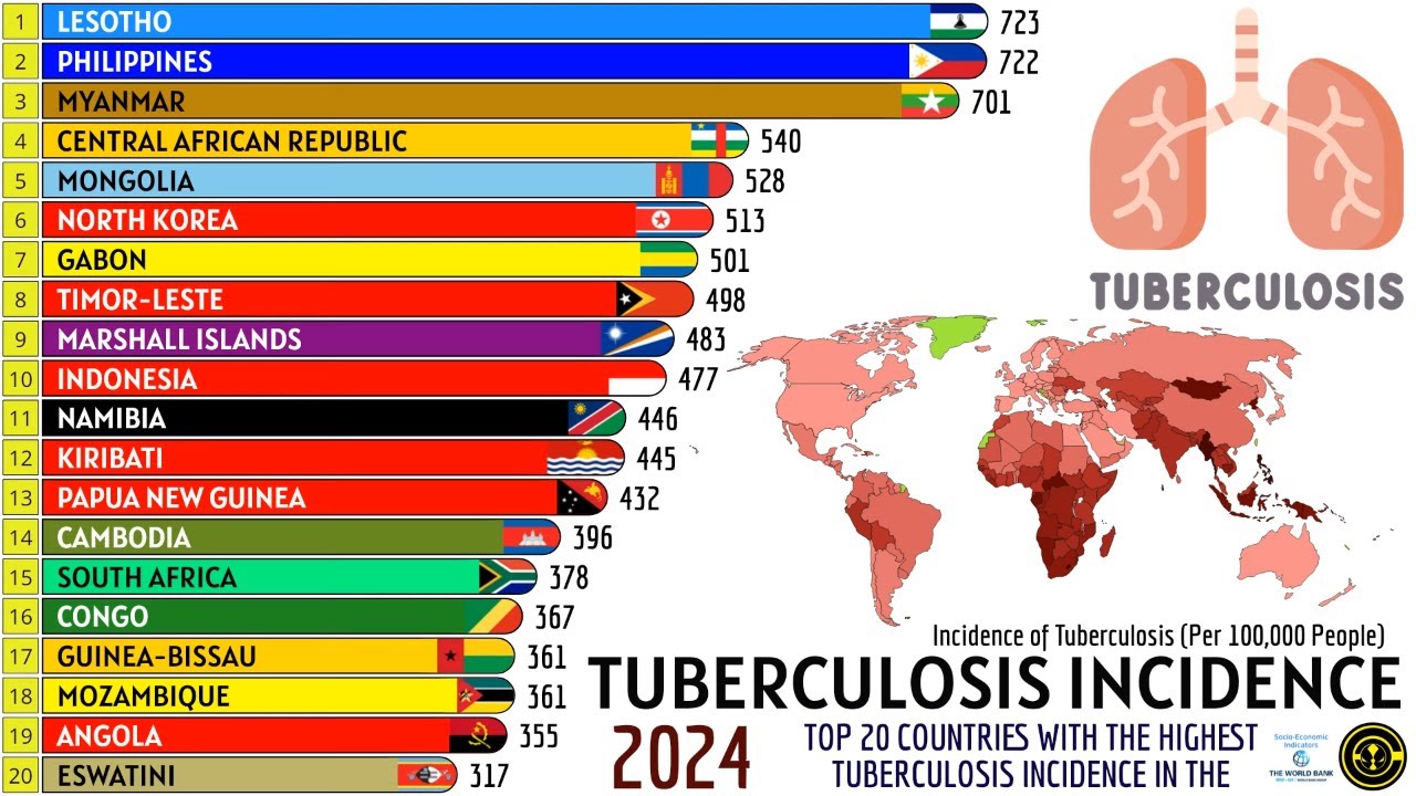 TOP 20 COUNTRIES WITH THE HIGHEST TUBERCULOSIS INCIDENCE IN THE WORLD ...