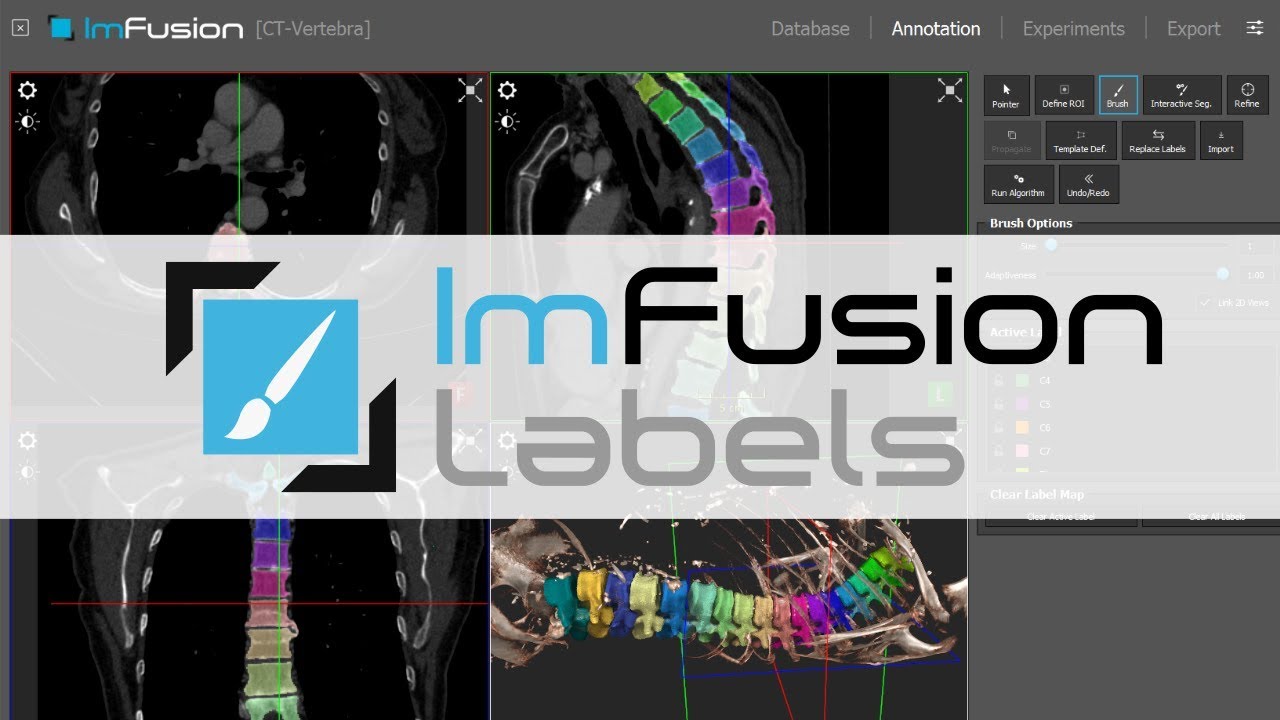 ImFusion Labels - Optimize your AI Workflow with Medical Images - YouTube