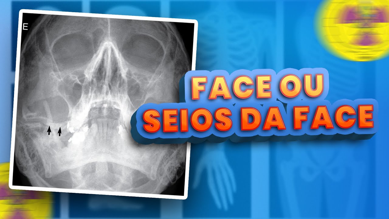 RAIO X DE FACE E SEIOS DA FACE APRENDA SUA DIFERENÇA | Radiologando ...