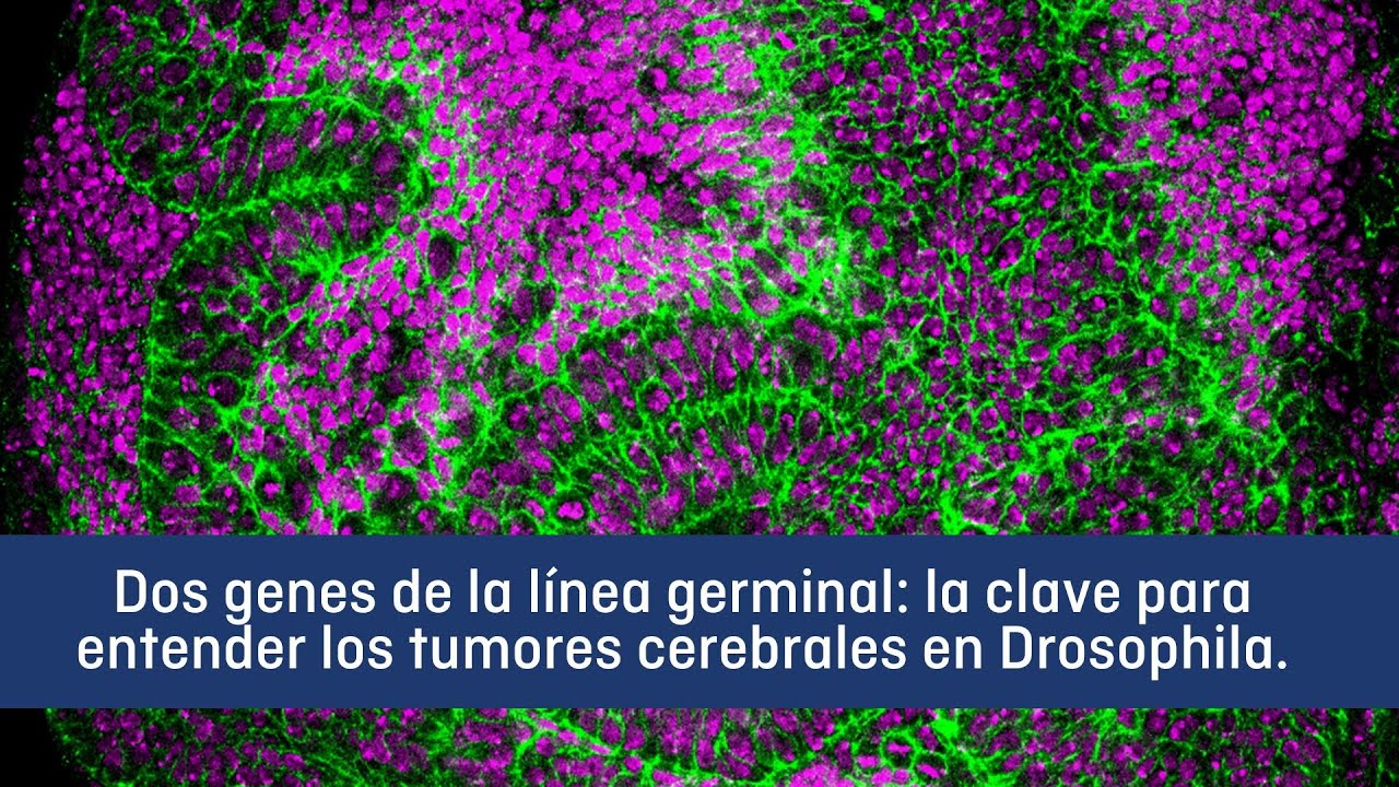 Dos genes de la línea germinal: la clave para entender los tumores ...