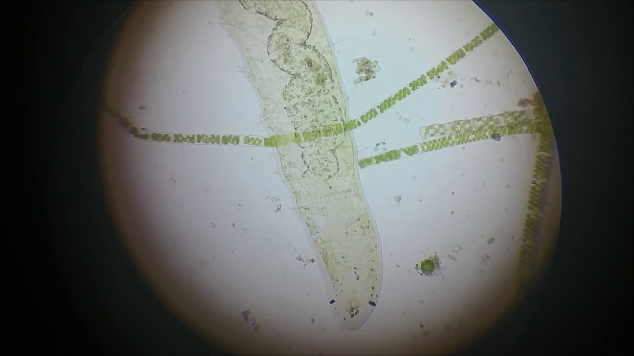 Worm in Microscope 2 - YouTube