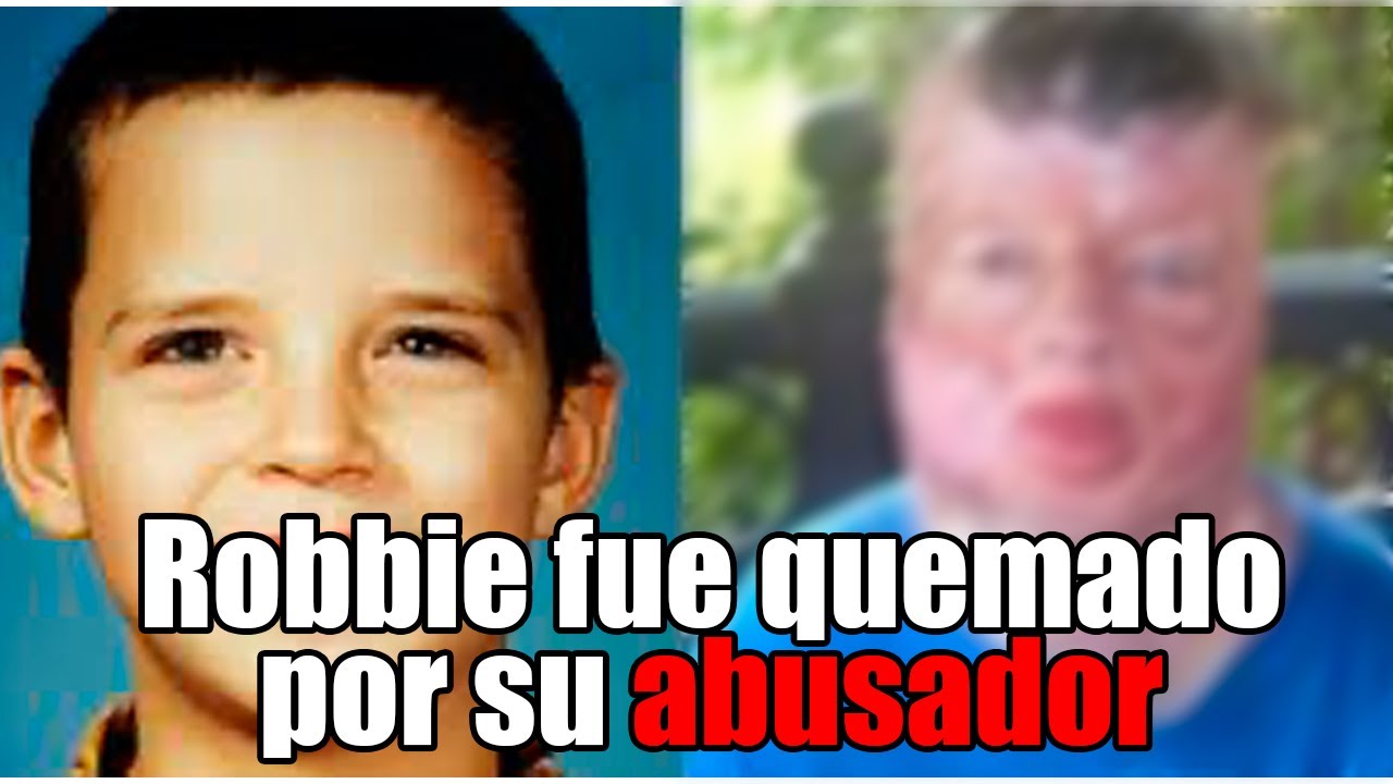 El aterrador y triste caso de Robbie Middleton - YouTube