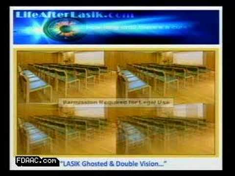 FDA Lasik Hearing: Dean Kantis - YouTube