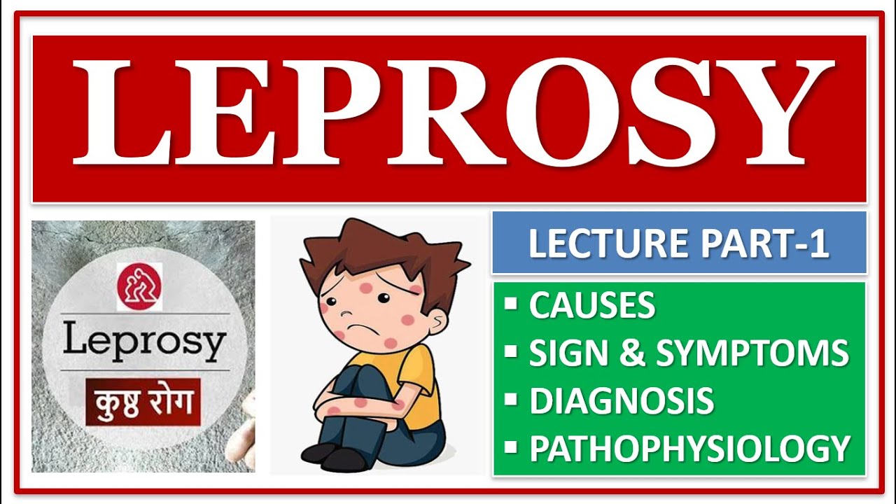 LEPROSY | PART-1 | CAUSES | SIGN & SYMPTOMS | DIAGNOSIS | RISK FACTORS ...