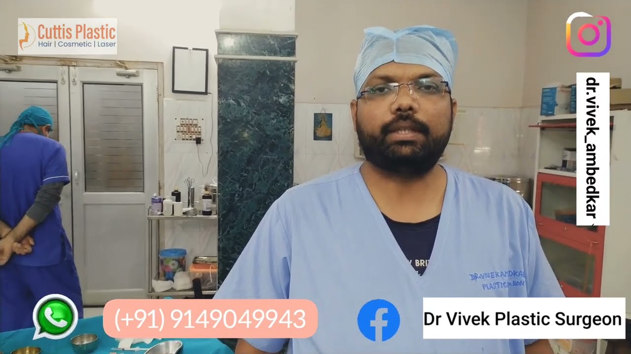 Frenuloplasty Surgery | Short Frenulum Tight Frenulum Phimosis Khatna ...
