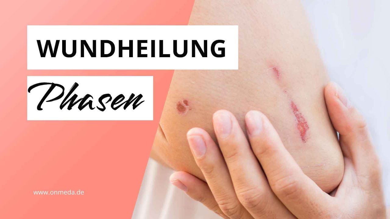 Wundheilungsphasen: So läuft die Wundheilung ab - YouTube