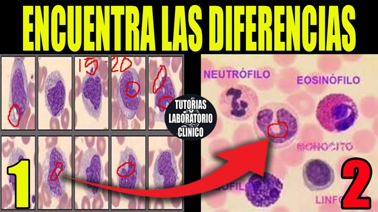 🩸Células Sanguíneas MADURAS de la Línea Blanca: Neutrófilo, Eosinófilo ...