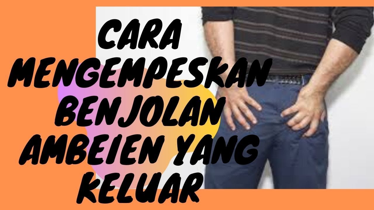 Cara Mengempeskan Benjolan Ambeien Yang Keluar - YouTube