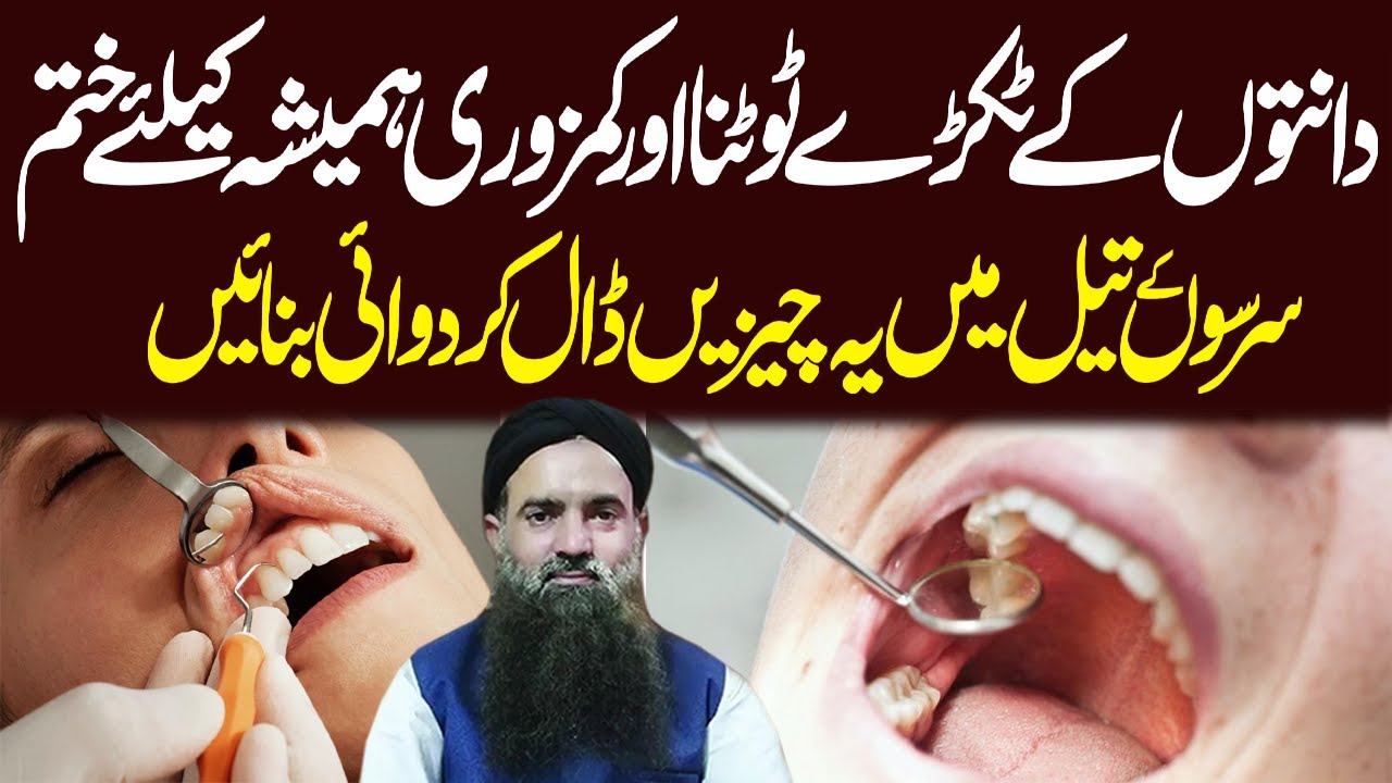 Dant Tootne Ka ilaj | Danto Me Dard Ka elaj | Adhay dant Totne ka elaj ...