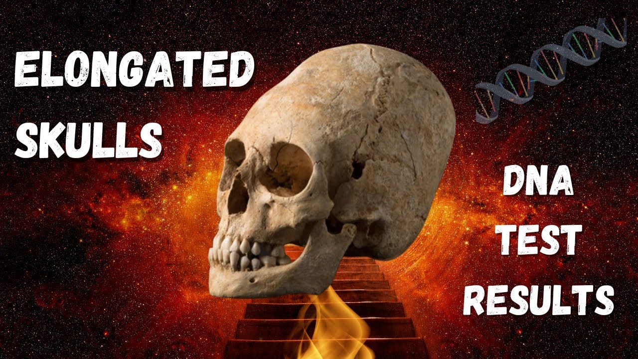 Elongated Skulls: What the DNA Tells Us - YouTube