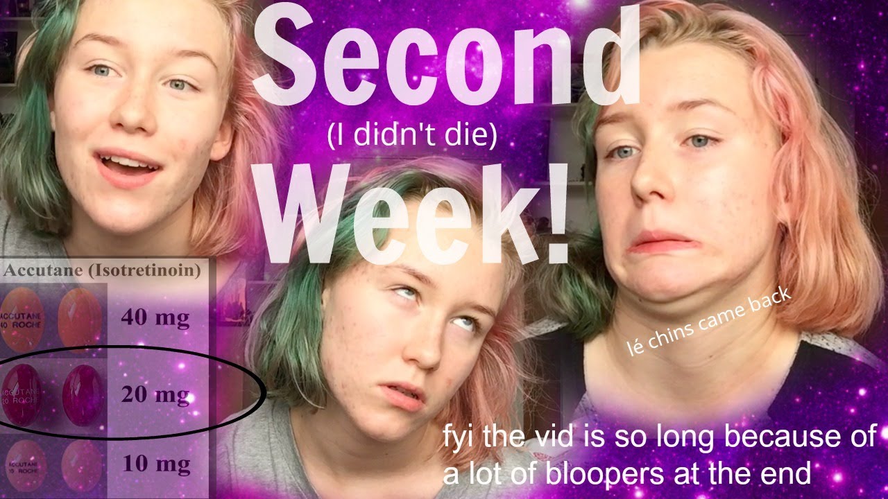 My Second Week On Accutane/ Isotretinoin (20mg) - TheAcneSeries#2 - YouTube