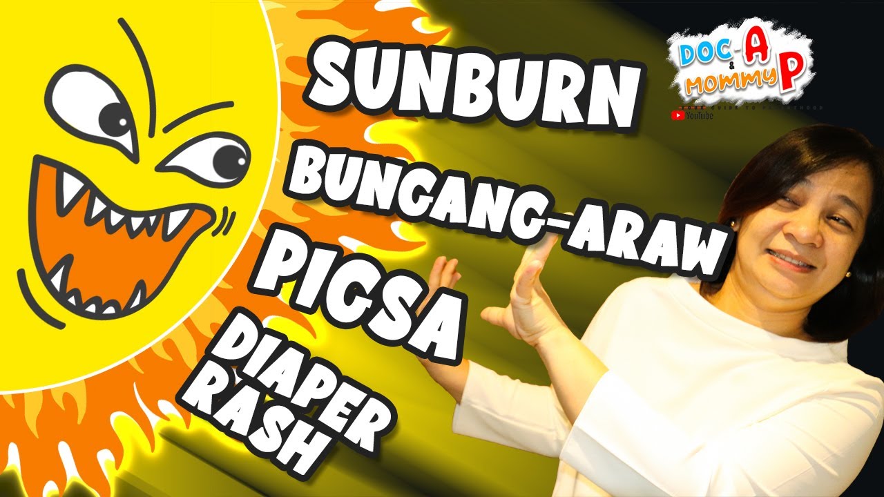 Paano ihandle ang SUNBURN, BUNGANG ARAW, PIGSA at DIAPER RASH | Doc-A ...