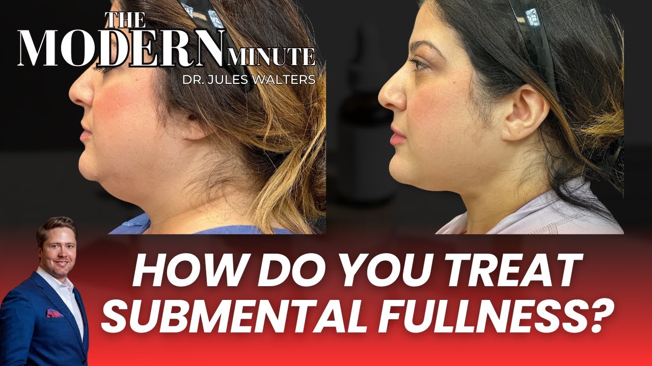 How Do You Treat Submental Fullness? - YouTube