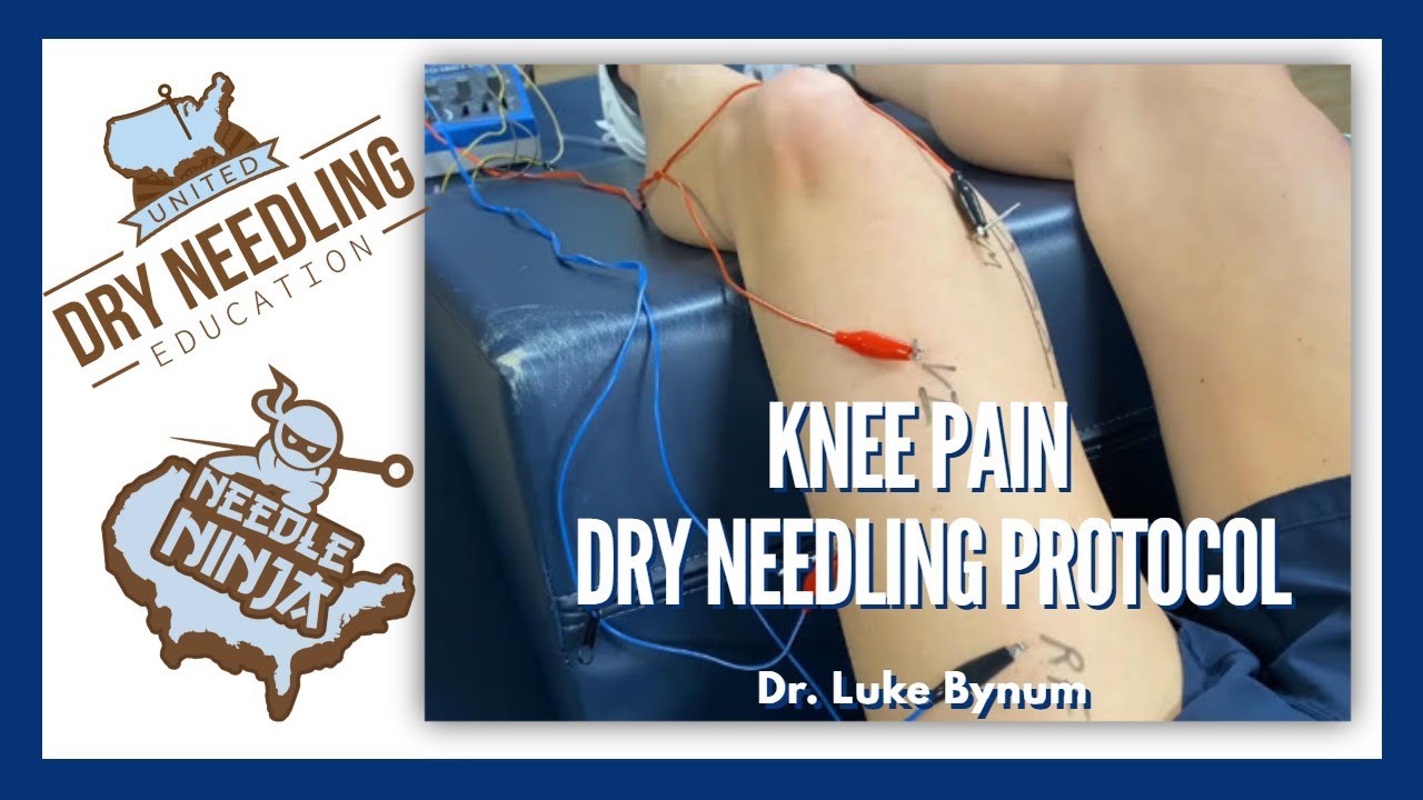 Knee Pain Dry Needling Treatment Protocol - YouTube