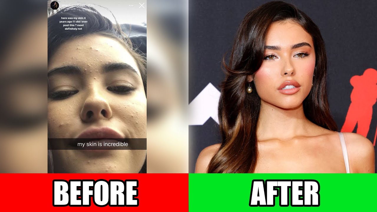 Madison Beer’s Tanning & Skincare Routine: Get Her Natural Sun-Kissed ...