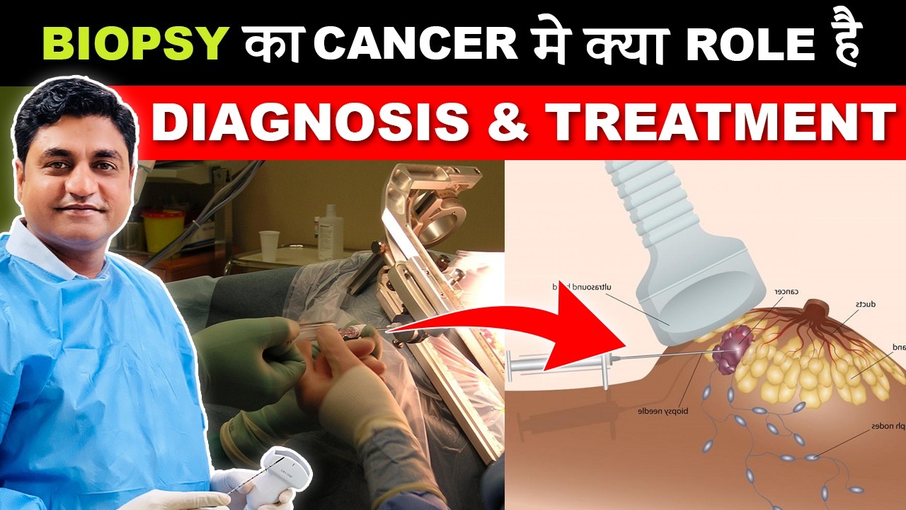 What is Biopsy and How it's Done? It's Role in The Cancer Diagnosis ...