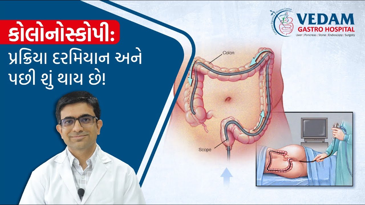 Colonoscopy : What Really Happens During and After the Procedure! - YouTube