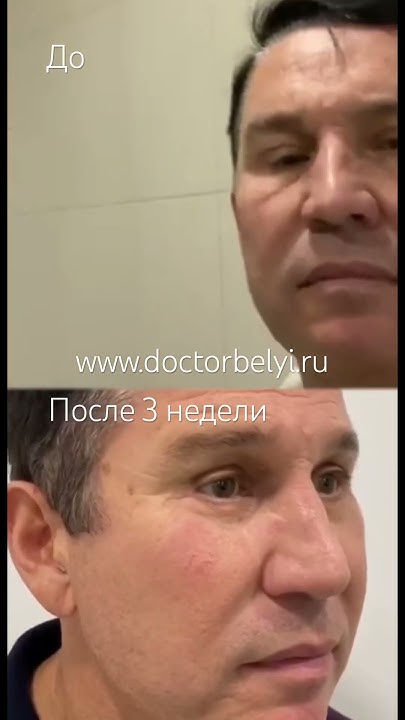 Это малярные мешки но к малярам ни какого отношения