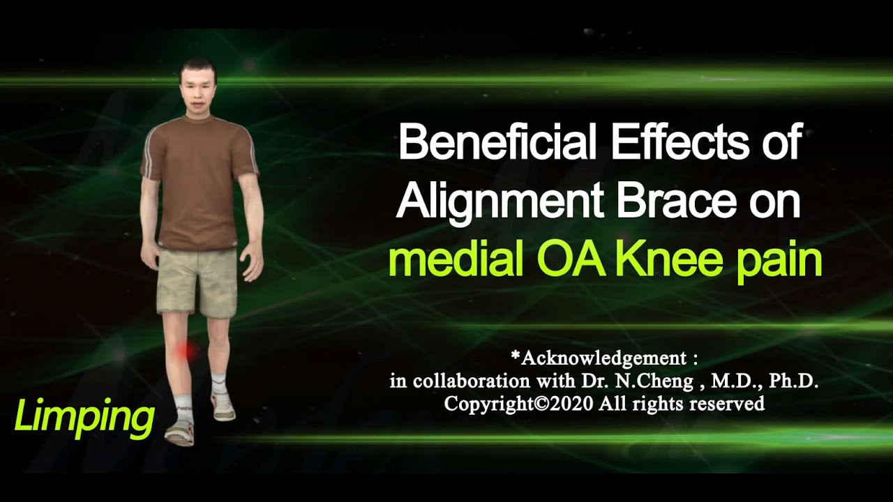 OA Knee Brace : Beneficial Effects of Alignment Brace on medial OA knee ...