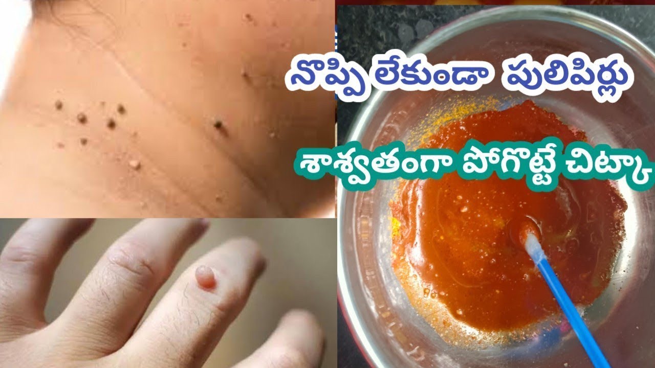 pulipirlu tagalamte em cheyali// pulipirlu / ఈ చిన్న టిప్ తో ...