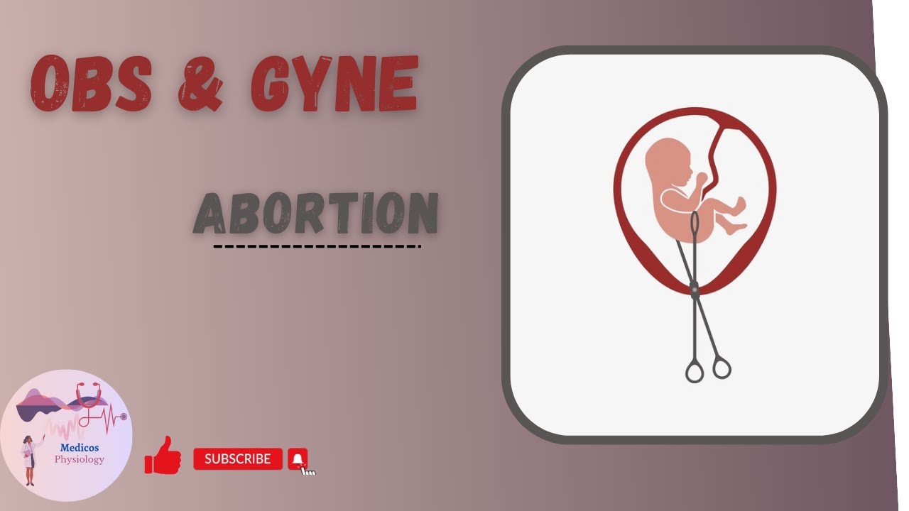 Abortion #obs #gyne #abortion - YouTube