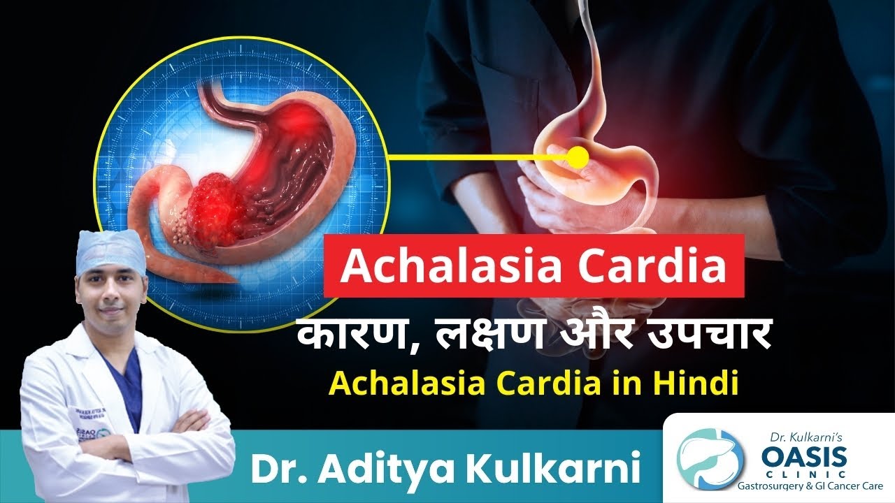 Achalasia Cardia: कारण, लक्षण और उपचार | Achalasia Cardia in Hindi | Dr ...