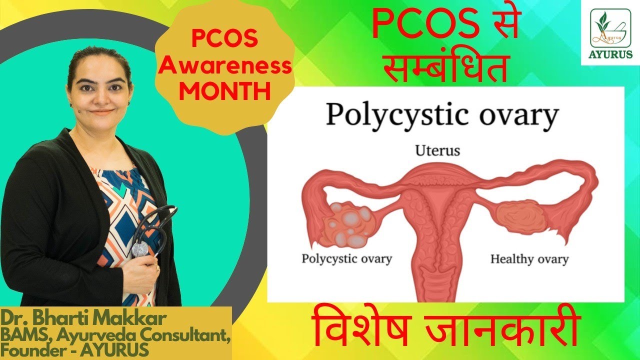 All about PCOS ; Who gets PCOS; What are the symptoms of PCOS; Is Pcos ...