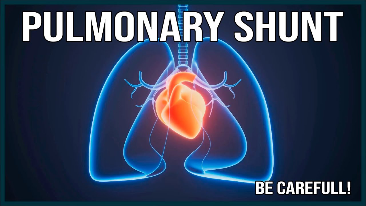 Pulmonary Shunt - A Heart Lung - YouTube