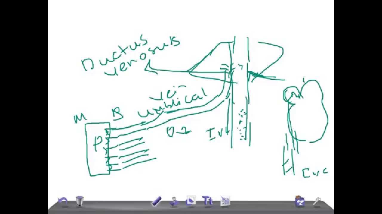 Medical Video Lecture: Fetal circulation Simplified - YouTube