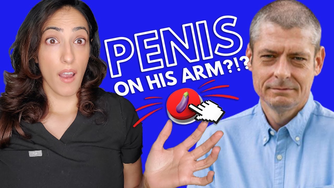 PENIS ON HIS ARM!?? | Neophallus for penile amputation - YouTube