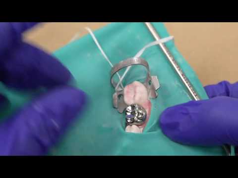 Stainless Steel Crown