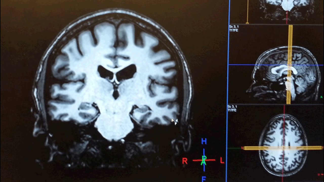 Designing "perfect" products with brain scans - YouTube