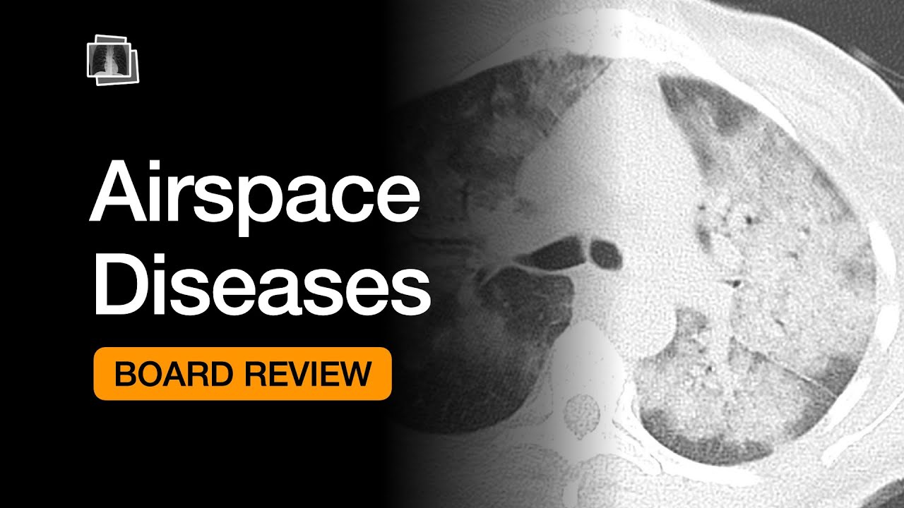 Airspace Diseases | Chest Radiology Board Review - YouTube
