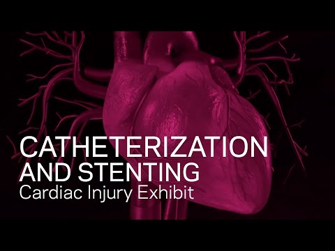 Cardiac Cath With Stent Placement