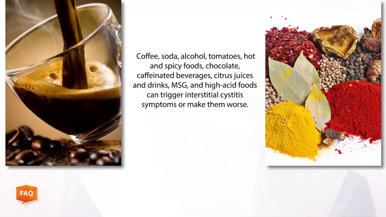 What foods trigger interstitial cystitis? - YouTube