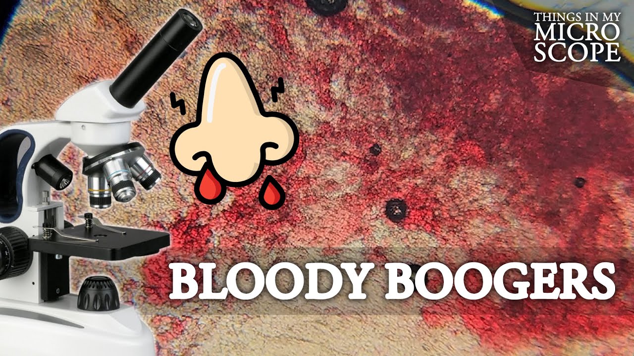 BLOODY BOOGER UNDER MICROSCOPE - 100X 250X 4K - YouTube