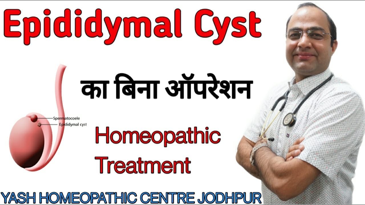 Epididymitis cyst homeopathic medicines |epididymitis treatment in ...