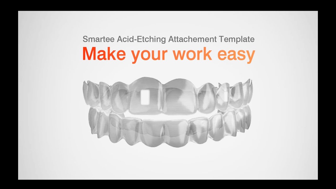 Smartee Acid Etching Attachment Template - YouTube