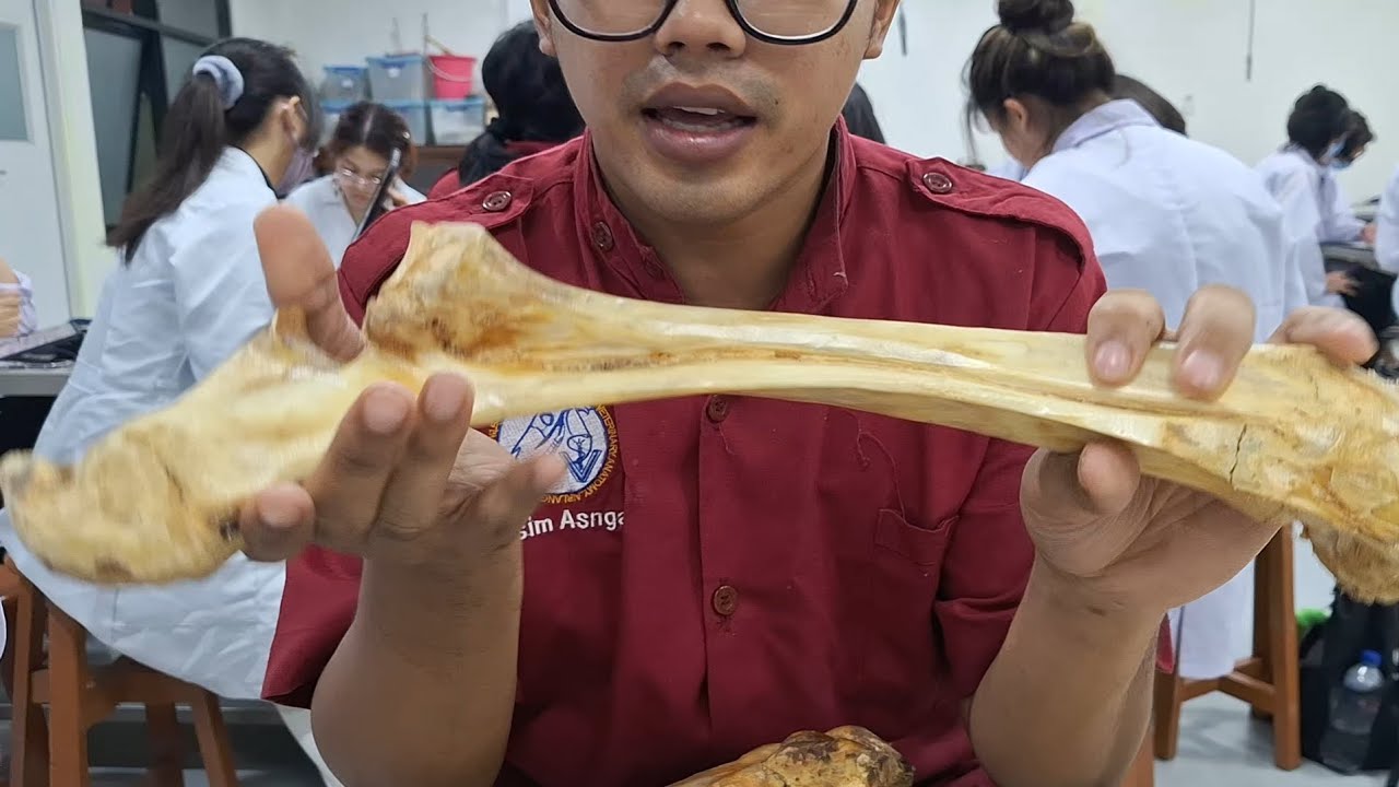 Osteology Ossa Membri Thoracici : Os Ulna & Os Radius - YouTube