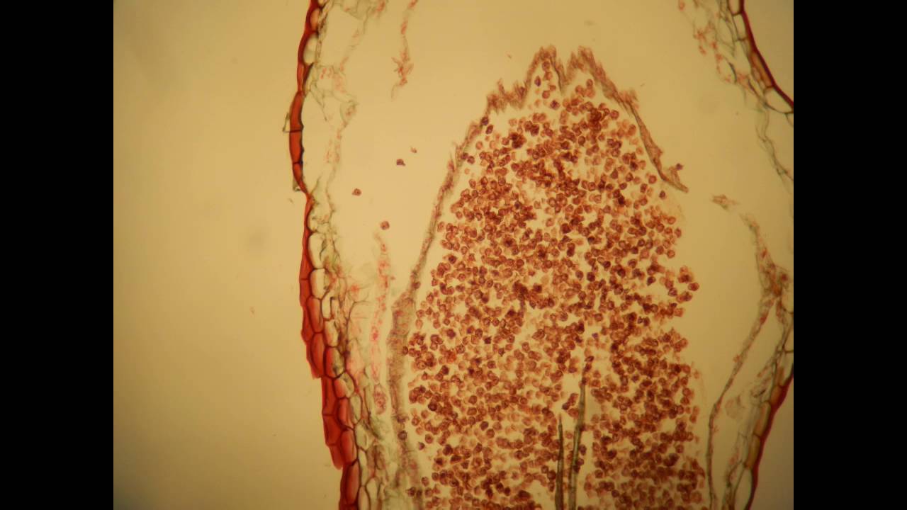 Moss Sporophyte Slide