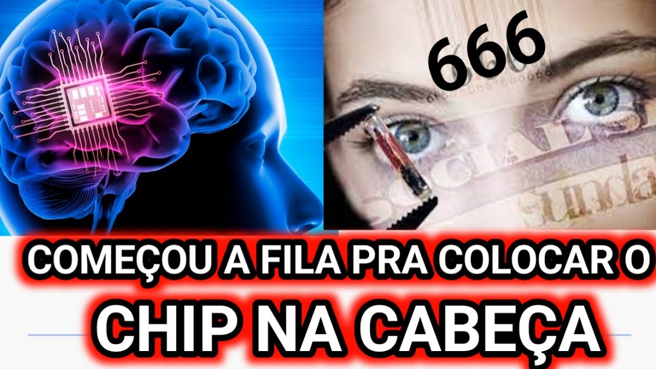 URGENTE! CHIP NA CABEÇA. COMEÇOU A FILA PARA A IMPLANTAÇÃO DE MICROCHIP ...