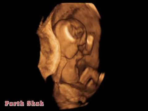 Body Stalk Anomaly 4 - YouTube