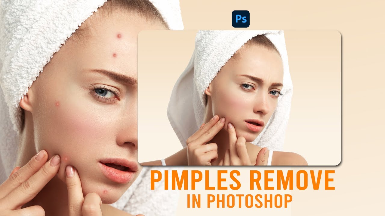 Remove Dark Spot In Photoshop Healing Tools Adobe Photoshop Spot remove-dark-spot-in-photoshop-healing-tools-adobe-photoshop-spot
