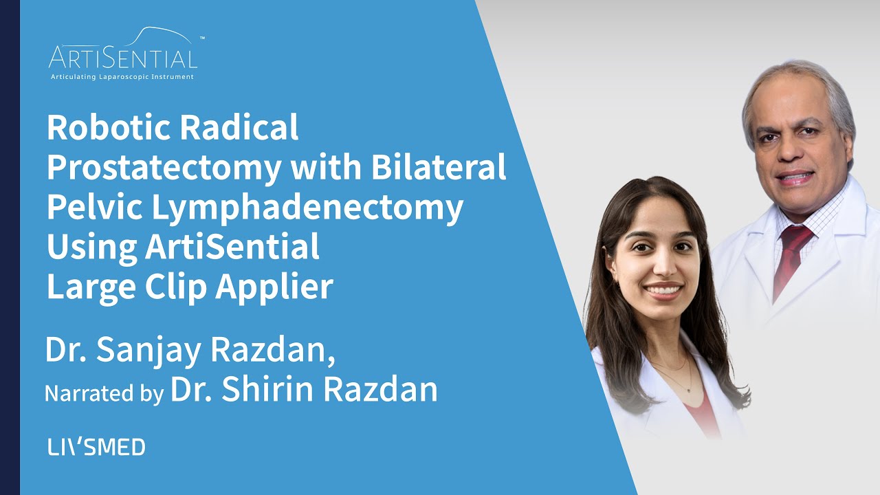 Robotic Radical Prostatectomy Using ArtiSential Large Clip Applier - Dr ...