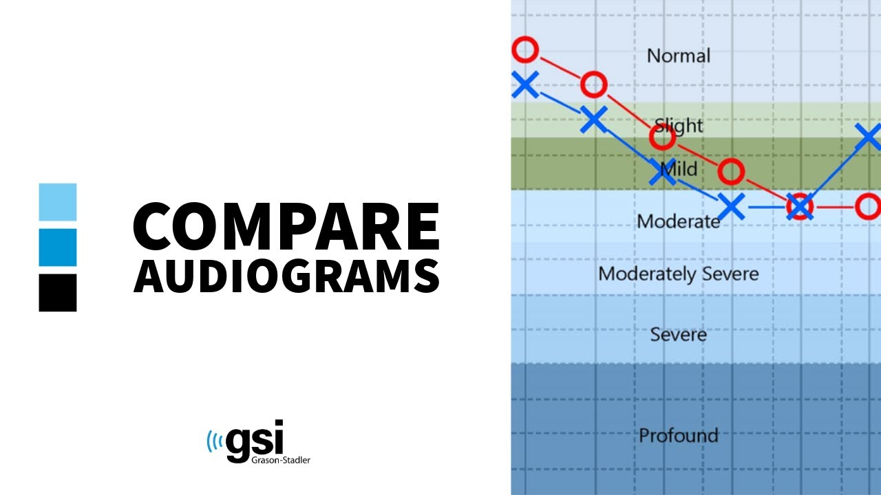 GSI Suite | How to Compare Audiograms - YouTube