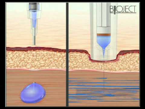 Biojector B2000 video - YouTube