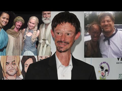 ‘Game of Thrones’ actor Darren Kent dead at 36 after health battle  : EastEnders actor