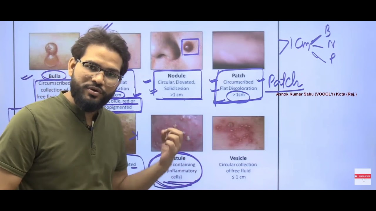 Bulla Macule Papule Pustul Nodule Vesicle Plaque Different Kind of Skin ...